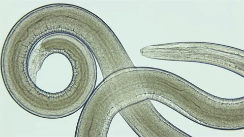 worm Nematoda under microscope, Phylum P... | Stock Video | Pond5