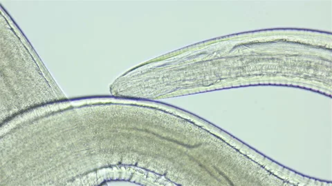 worm Nematoda under microscope, Phylum P... | Stock Video | Pond5