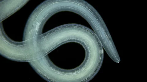 worm Nematoda under microscope, Phylum P... | Stock Video | Pond5