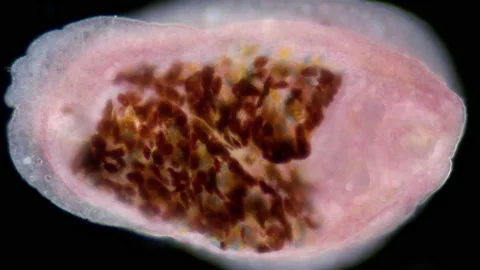 Worm order Prolecithophora under a micro... | Stock Video | Pond5