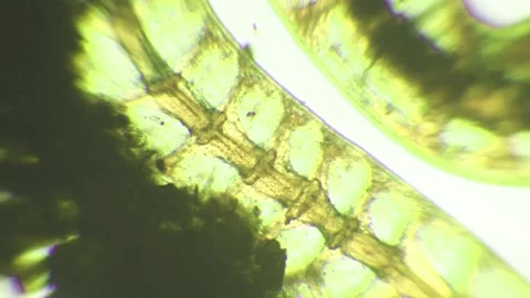 Worm under the microscope, detail of the... | Stock Video | Pond5