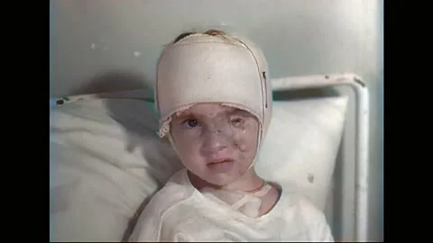 WW2 - Child with war injury in hospital | Stock Video | Pond5