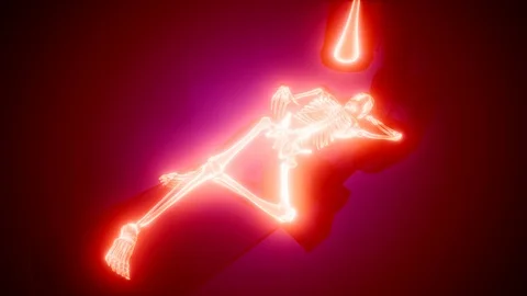 x-ray examination medical footage | Stock Video | Pond5