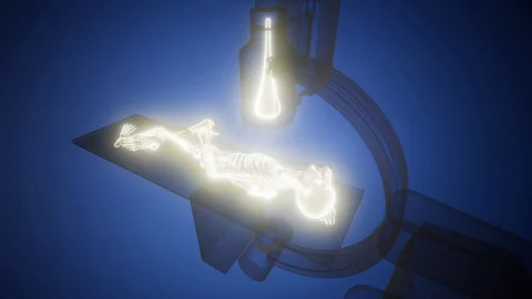 x-ray examination medical footage | Stock Video | Pond5