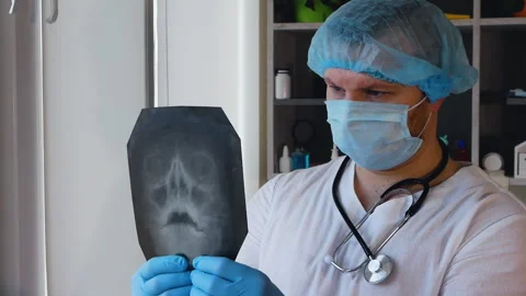 X-ray of the human brain. The doctor ana... | Stock Video | Pond5