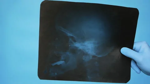 X-ray of the human brain in the doctor's... | Stock Video | Pond5