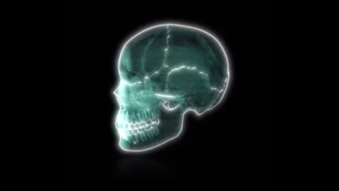 X-ray scan Brain loop black background | Stock Video | Pond5