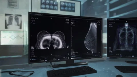 X-ray scanning the woman patient breasts... | Stock Video | Pond5