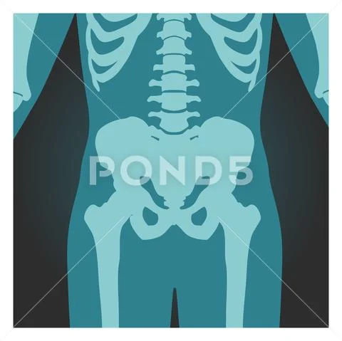 X-ray shot of pelvis and spinal column, human body bones, radiography ...
