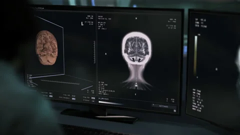 X-ray software diagnosing multiple injur... | Stock Video | Pond5