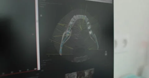 X-rays of the jaws on the screen in the ... | Stock Video | Pond5