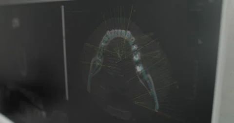 X-rays of the jaws on the screen in the ... | Stock Video | Pond5
