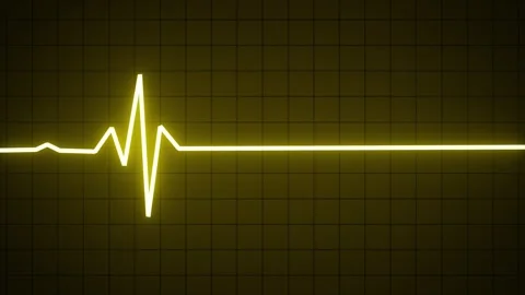 Yellow neon ECG pulse rate line. EKG pul... | Stock Video | Pond5