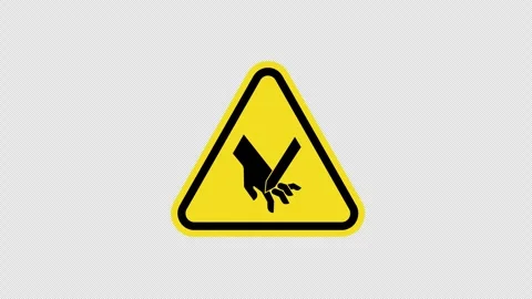 Crush Injury Stock Videos – Royalty-Free HD & 4K Videos | Pond5