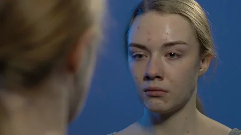Young crying girl looking at face acne i... | Stock Video | Pond5