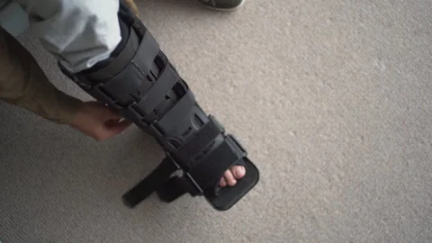 Young man with leg injury using Splint, ... | Stock Video | Pond5