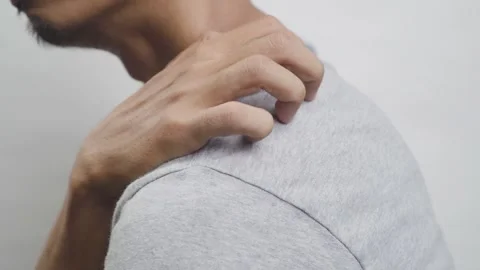 Scratching Skin Stock Footage ~ Royalty Free Stock Videos | Pond5