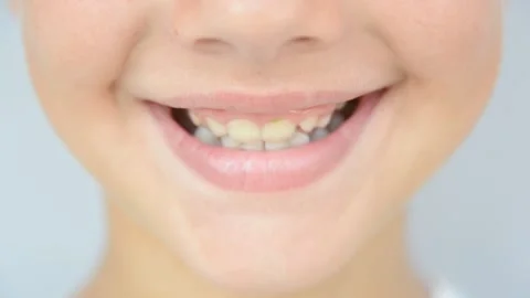 Young smiling boy close up. Positive chi... | Stock Video | Pond5