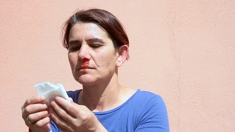 Nosebleed Stock Footage ~ Royalty Free Stock Videos | Pond5