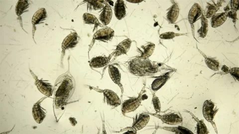 Zooplankton under the microscope. | Stock Video | Pond5